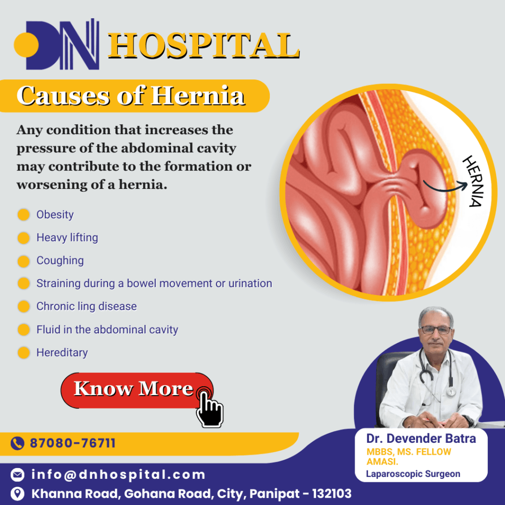 Types of Hernia - DN Hospital
